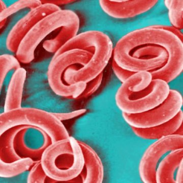 Study: New immune pathway involved in resistance to parasite worms ...