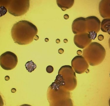 Research: In studies in humans and mice, bacteria confuse the metal ...