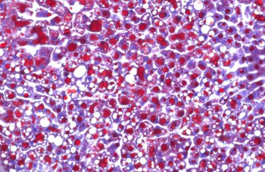 Study: Causes of cortisone-induced side effects — (Details) | Tdnews Study: Causes of cortisone-induced side effects — (Details) | Tdnews
