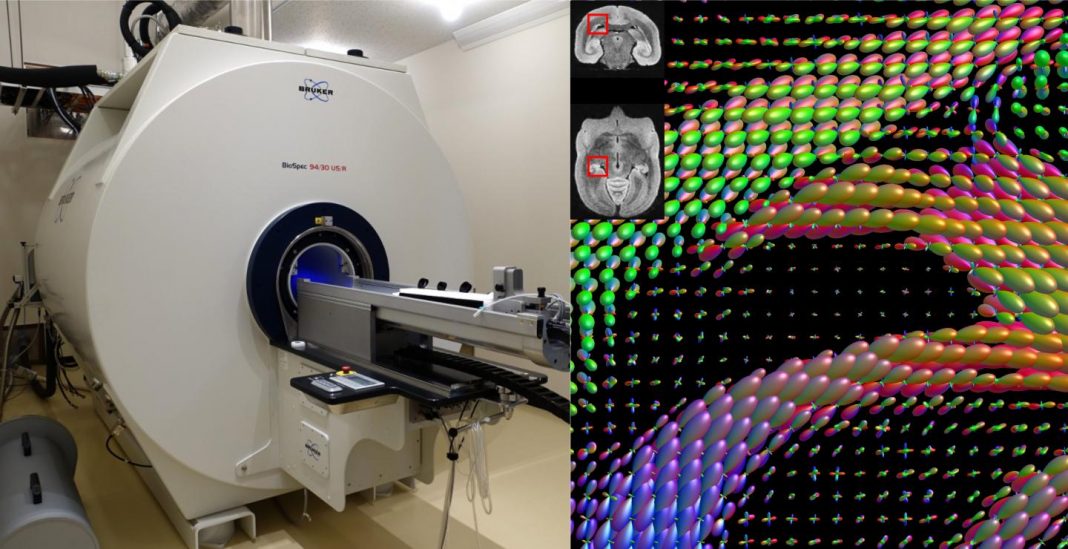 Biology: Machine intelligence accelerates study into mapping brains ...