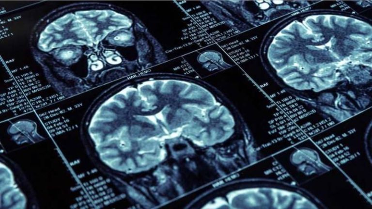 Poverty's Lasting Effects on the Brain - Tdnews