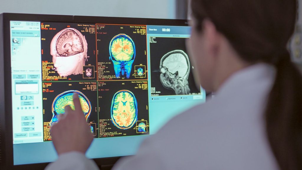 Researchers find that curiosity makes the brain learn better - Tdnews